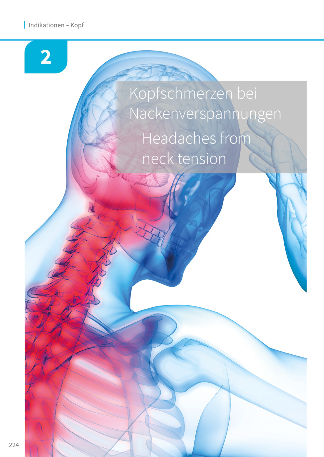 Kopfschmerzen, Myogelosen – Okamed Akademie